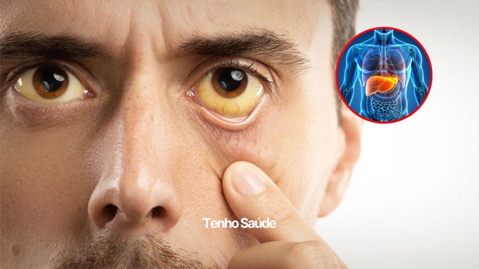 5 sinais iniciais de problemas no fígado - Tenho Saúde